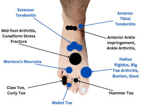 The Ultimate Foot Pain Chart: Everything You Need to Know - MediCure Wise